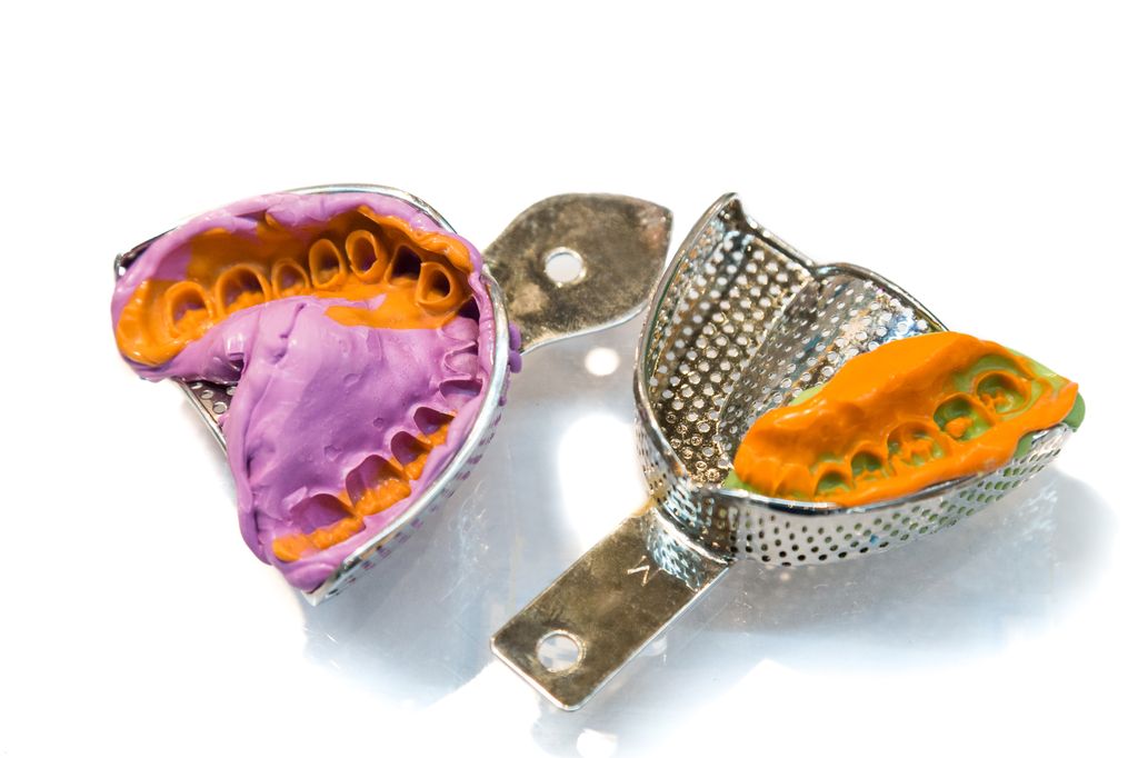 Dentist dental teeth impression mold with compound | 上本町駅・谷町九丁目駅の歯医者【近藤歯科】